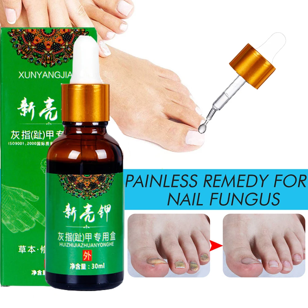 Купить Искусство ногтей и инструменты | Onychomycosis Nail Repair ...