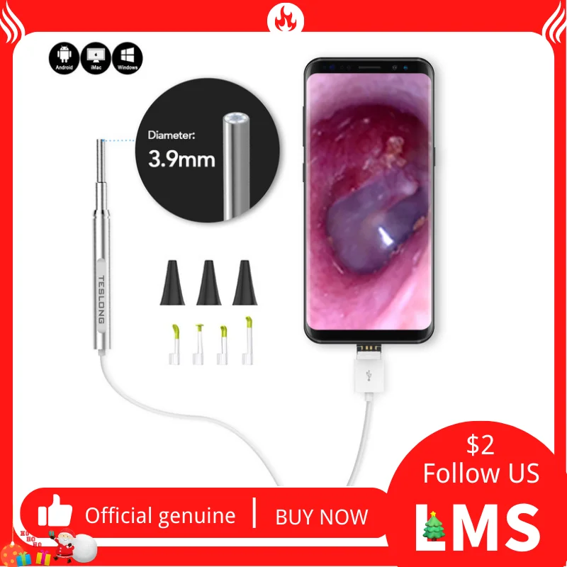 Купить Видеонаблюдение | Otoscope Medical Ear Scope Endoscope 3.9mm ...